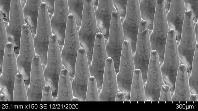 Skin-Patch Vaccine for Dengue Fever Successful in Preclinical Models ...