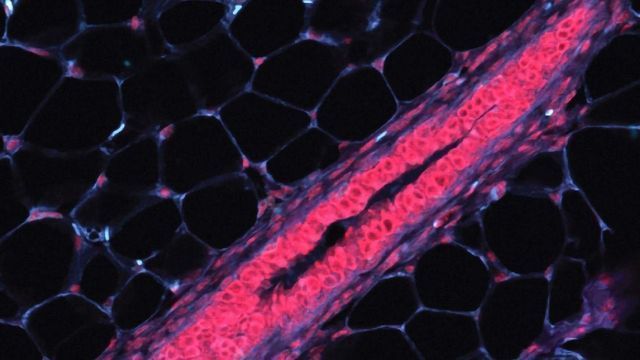 Cataloging Cells To Pinpoint Origins of Breast Cancer | Technology Networks