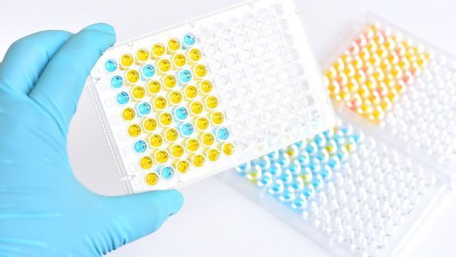 Eight Tips for Ensuring a Successful ELISA | Technology Networks
