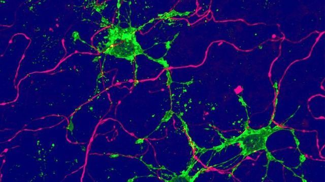 New Types of Glial Cell Identified Could Help Repair the Brain ...