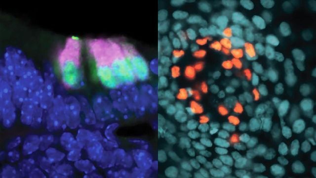 A Common Ancestor for Cells Involved in Hearing and Touch | Technology ...