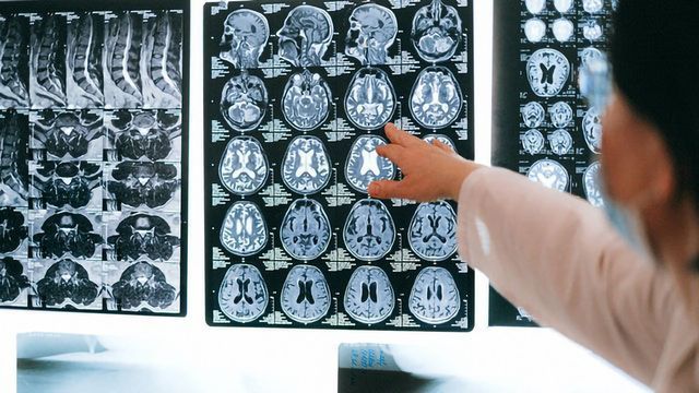 Growing Pains? Size Chart for Childhood Brain Development Created ...