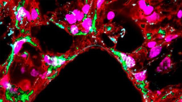 New Insights Into How Cells Sense and Respond to Forces | Technology ...