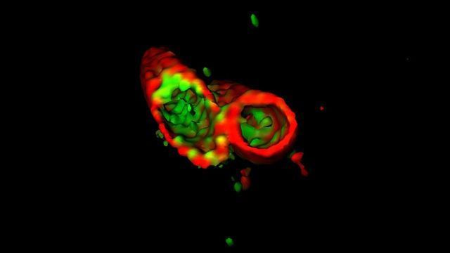 Human Cells Harness Power of Detergents To Wipe Out Bacteria ...