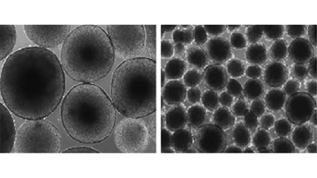 “Mini Brains” Mimic Head Size Changes Found in Autism | Technology Networks