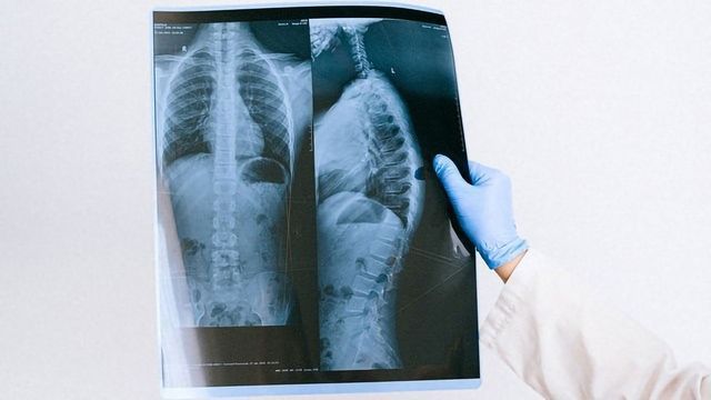Old Radiology Reports Used by AI To Understand Medical Images ...