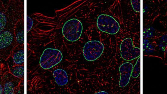 Organelle Marker Selection Guide Poster | Technology Networks