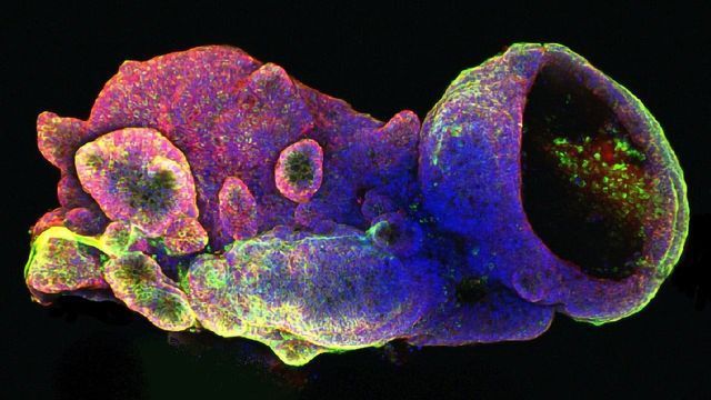 Cultrex UltiMatrix Reduced Growth Factor Basement Membrane Extract ...