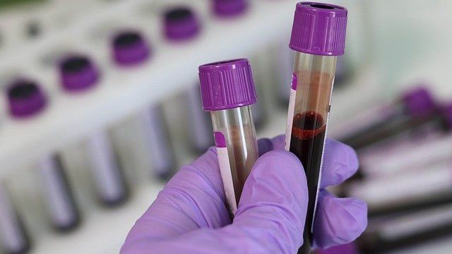 Single Blood Test Measures T-Cell and Antibody Response to SARS-CoV-2 ...
