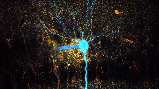 New Imaging Technique Reveals Causes of Swelling in the Brain ...