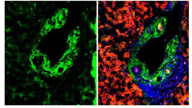 Team Discovers How Tumor Suppressor pVHL Influences Cell Signaling ...