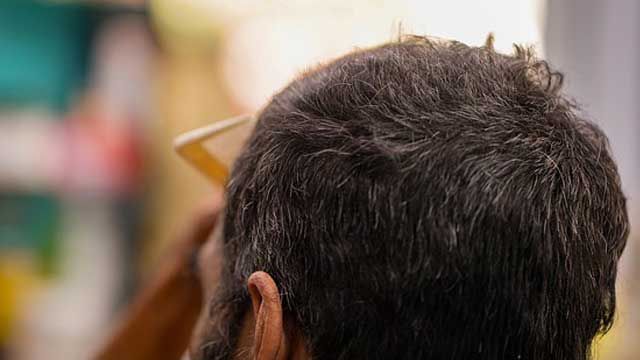 1 in 3 Alopecia Patients Receiving Arthritis Drug Regrow Hair in Phase ...
