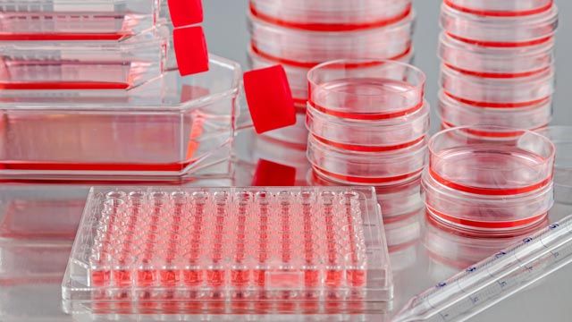 Cell Culture Advances for Vaccine Development and Production ...