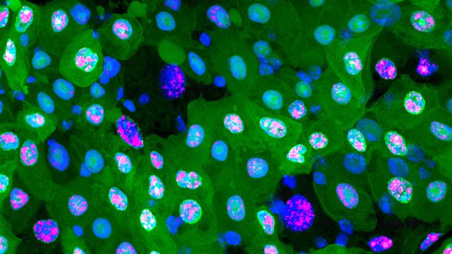 New Type of Cell Death Discovered in Fly Guts | Technology Networks