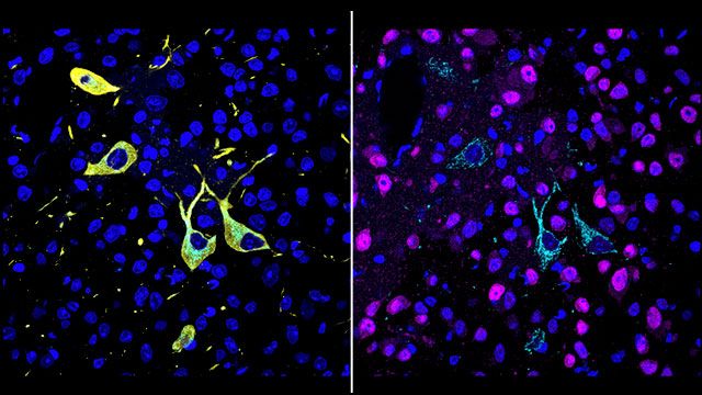 New Method Reveals How And Where Drugs Hit Their Targets Technology