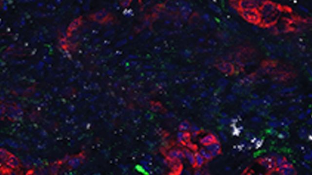 Tyramide Signal Amplification (TSA) Vivid Fluorophore Kits | Technology ...