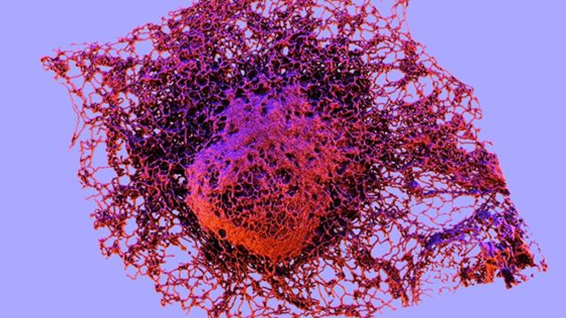 Promising New Compound Kills Several Hard-To-Treat Cancers | Technology ...