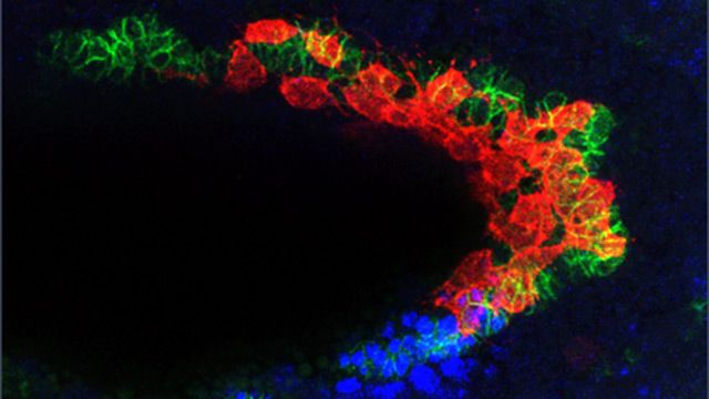 Mechanisms That Ensure Wandering Cells Will Self-Destruct Revealed ...