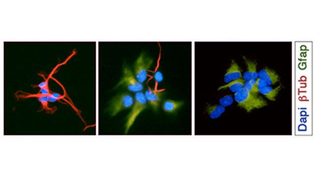 The Origins of the Brain's Star Cell | Technology Networks