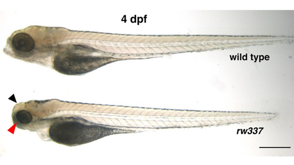 How a Mutated Eye Offers Insight into Cancer Development | Technology ...