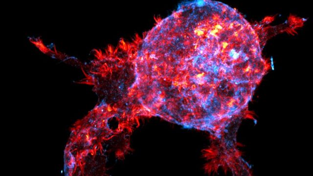 Sticky Cell Protrusions Help To Contain Breast Tumors | Technology Networks