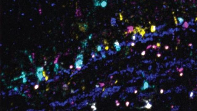 Tracing the Map of Smell in the Brain | Technology Networks