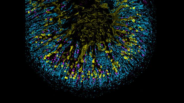 Central Functions of Innate Immune Cells Discovered | Technology Networks