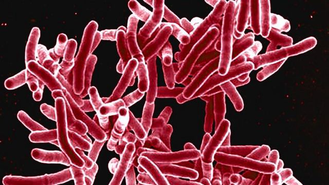 Unusual Bone-Eating TB Resembles an Ancient Form | Technology Networks
