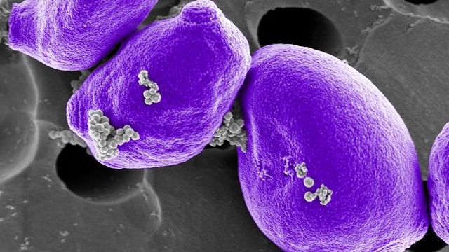 Novel Method Enables Rapid Identification of Microbial Pathogens in ...