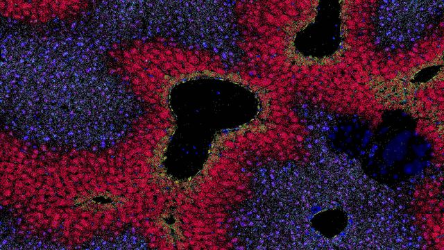 Spatial Transcriptomics in Human Cell Atlas Studies Infographic ...