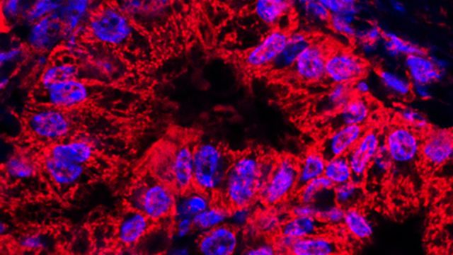 Discovery of Cell Origins Linked to Pancreatic Cancer Paves Way for New ...
