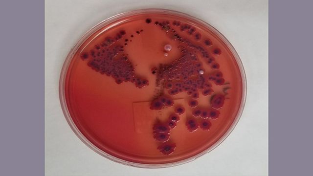 Origins and Transmission Patterns of Seattle Shigella Outbreak ...