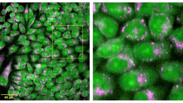High-Throughput Chemical Imaging May See Raman Microscopy in the Clinic ...