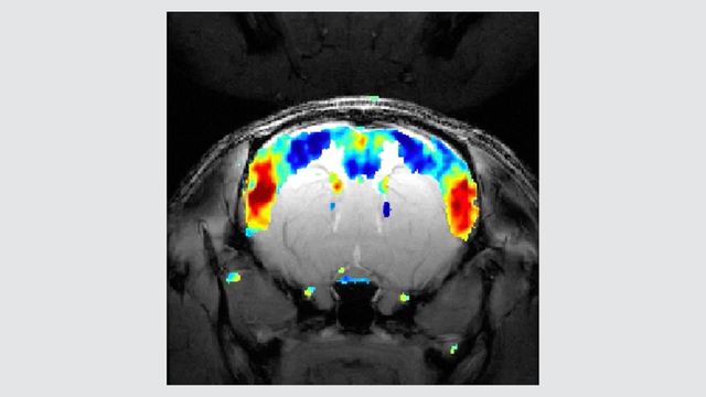 Resonant Waves Form Connections Between Distant Brain Regions Technology Networks