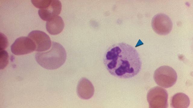 Immune Cells' Ability To Destroy Invaders Suppressed by PFAS ...