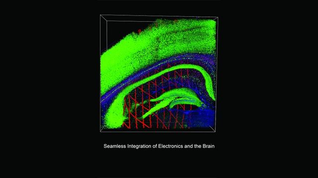 Scientists Record Electrical Activity From A Single Brain Cell For More Than A Year Technology