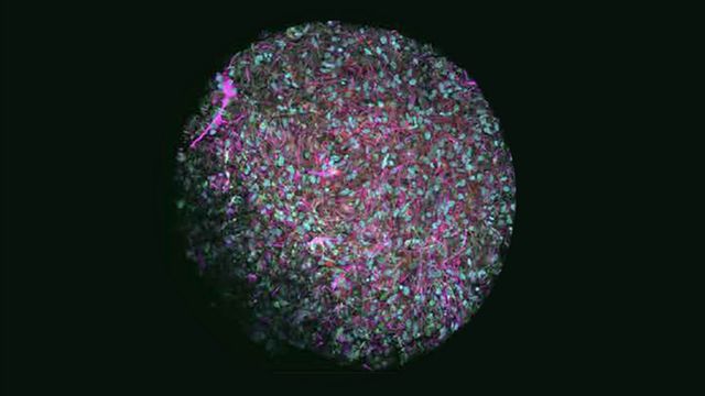 Brain Cell-Powered Computers Could Be the Future of AI | Technology ...