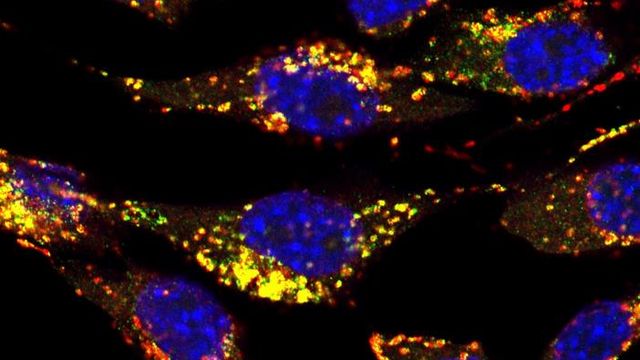 Cellular Waste Removal Differs According to Cell Type | Technology Networks