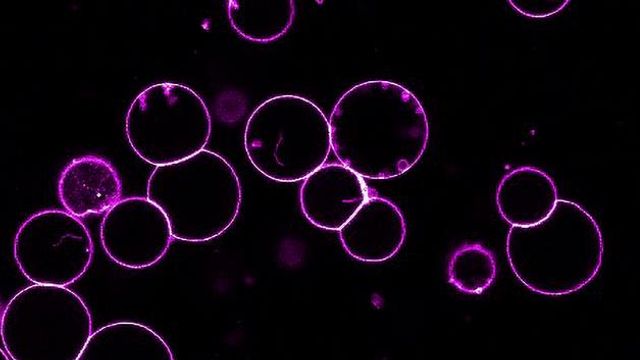 Muscle Health Is Dependent on Lipid Synthesis | Technology Networks