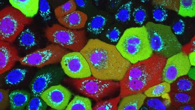 New Intracellular "Smoke Detector" Discovered | Technology Networks