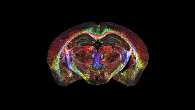New Scanner Produces Most Detailed Brain Images Ever Captured ...