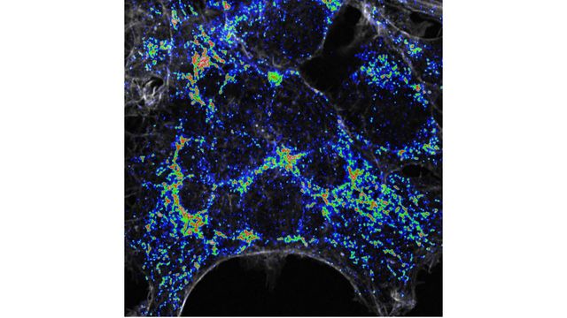 New Understanding of Cellular Response to Metabolic Stress | Technology ...