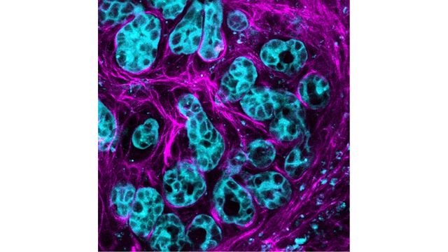 Pancreatic Cancer Imaging Reveals Insights Into Drug Response And