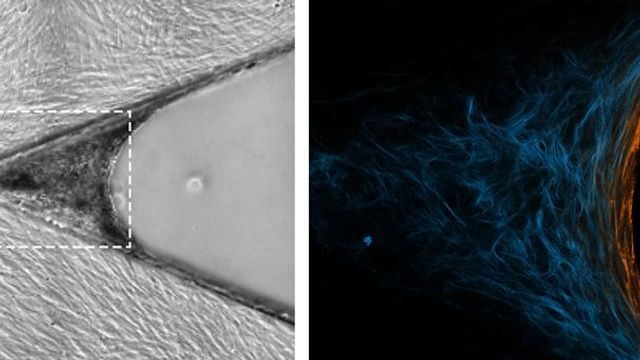 How Are Cells Influenced by Their Environment as Tissues Grow ...