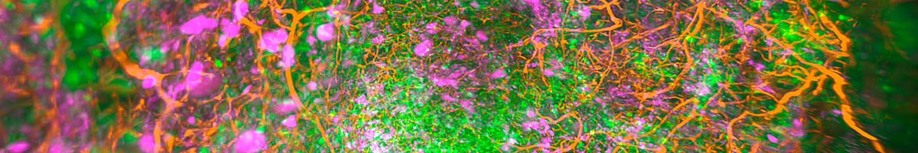 Exploring Tumor Innervation With Tissue Clearing and 3D Imaging Webinar ...