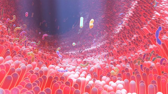New Insights Into the Link Between Gut Bacteria Makeup and Alzheimer's ...