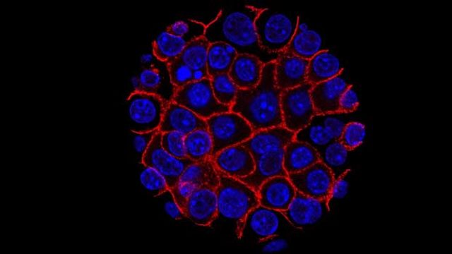 Three Pronged Immunotherapy Combination Shows Early Promise For Pancreatic Cancer Technology