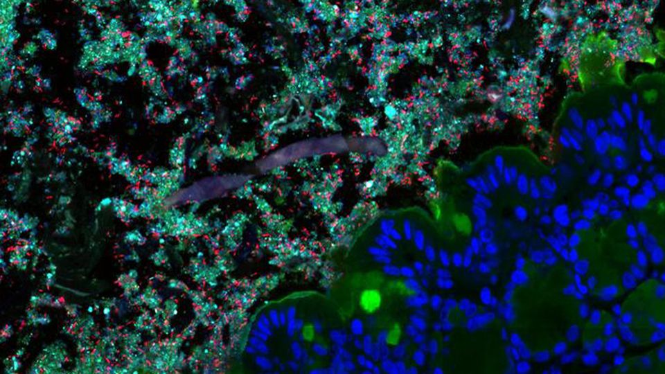 Diverse Gut Bacteria Communities Block Harmful Pathogens From Nutrients ...