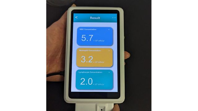 Handheld White Blood Cell Tracker Developed | Technology Networks