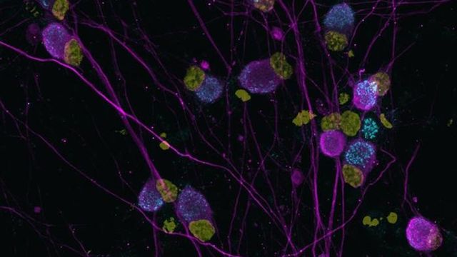 Second Ion Channel Associated With Touch Perception Discovered ...